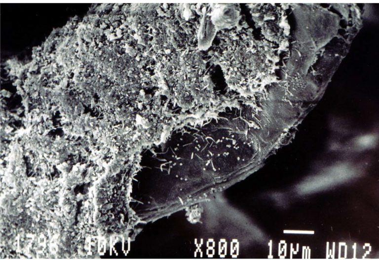Oral Malodour – European Association of Oral Medicine